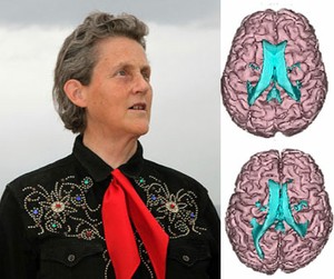 Researchers reveal first brain study of Temple Grandin