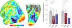 Finally this week, a new neuroimaging study is the first to reveal how the