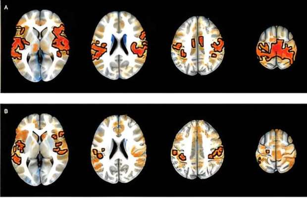 A team of neuroscientists has found that so-called