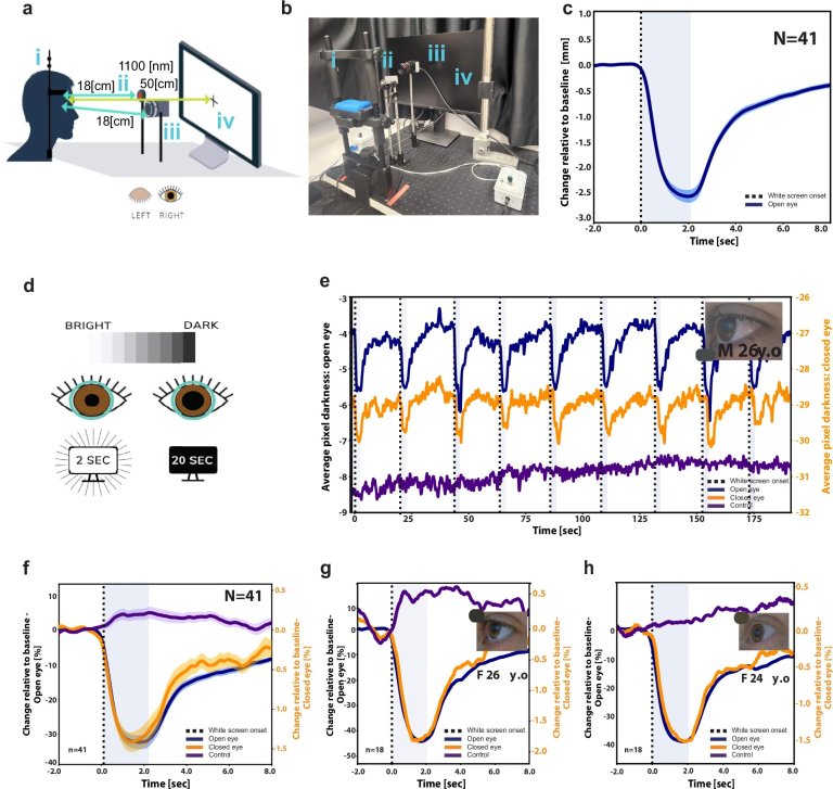 Pupillary light reflex (PLR) assessment in open-eye and closed-eye ...