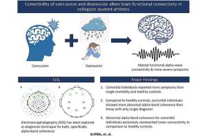Credit: Brain Research (2 024 )